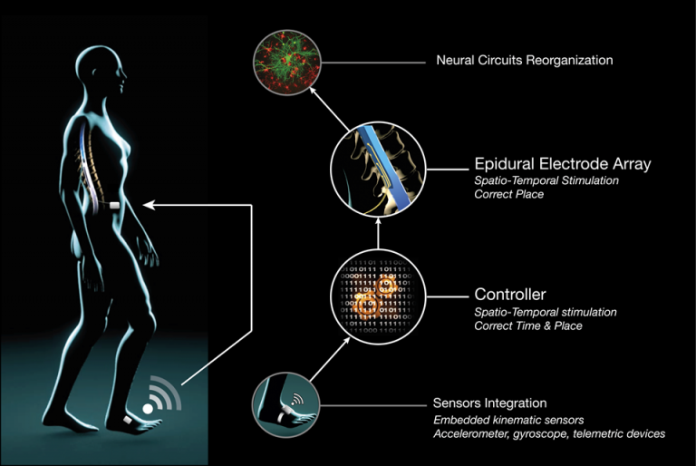 Rehabilitation Technologies ‒ BioRob ‐ EPFL