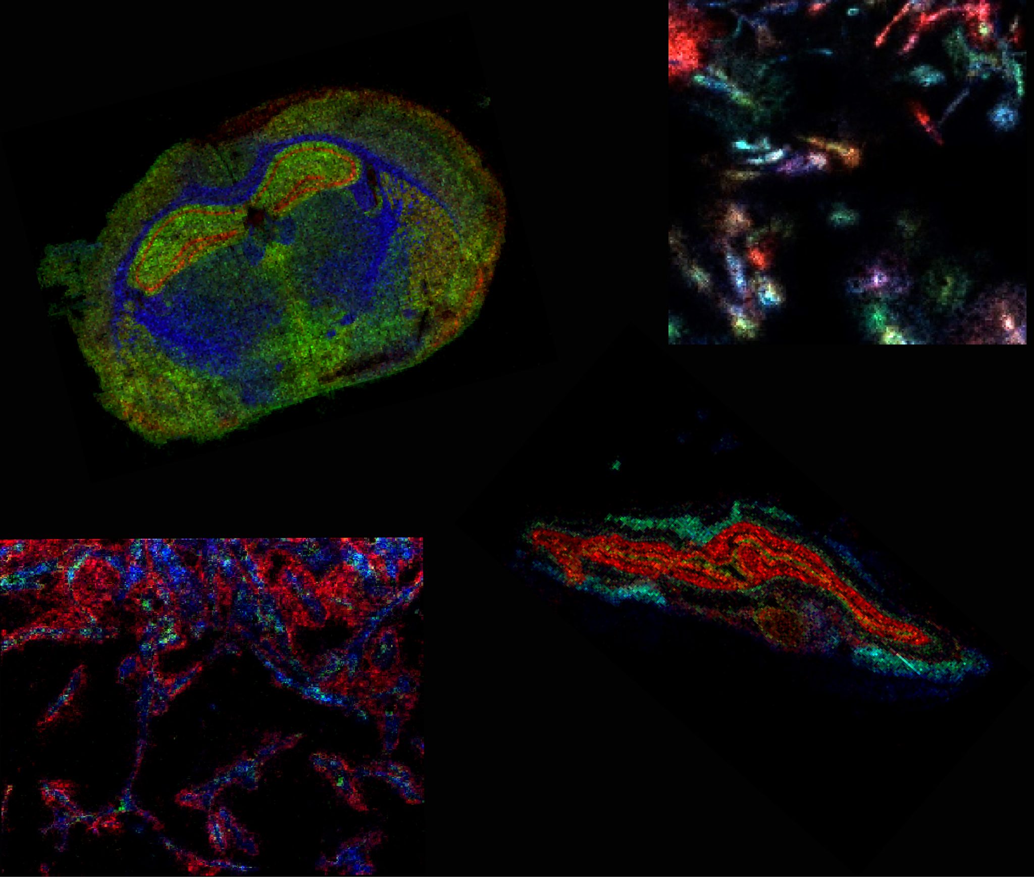 In-situ single cell lipidomics by Imaging Mass Spectrometry ...