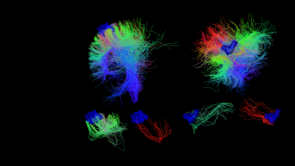 SecondS ‒ UPHUMMEL ‐ EPFL