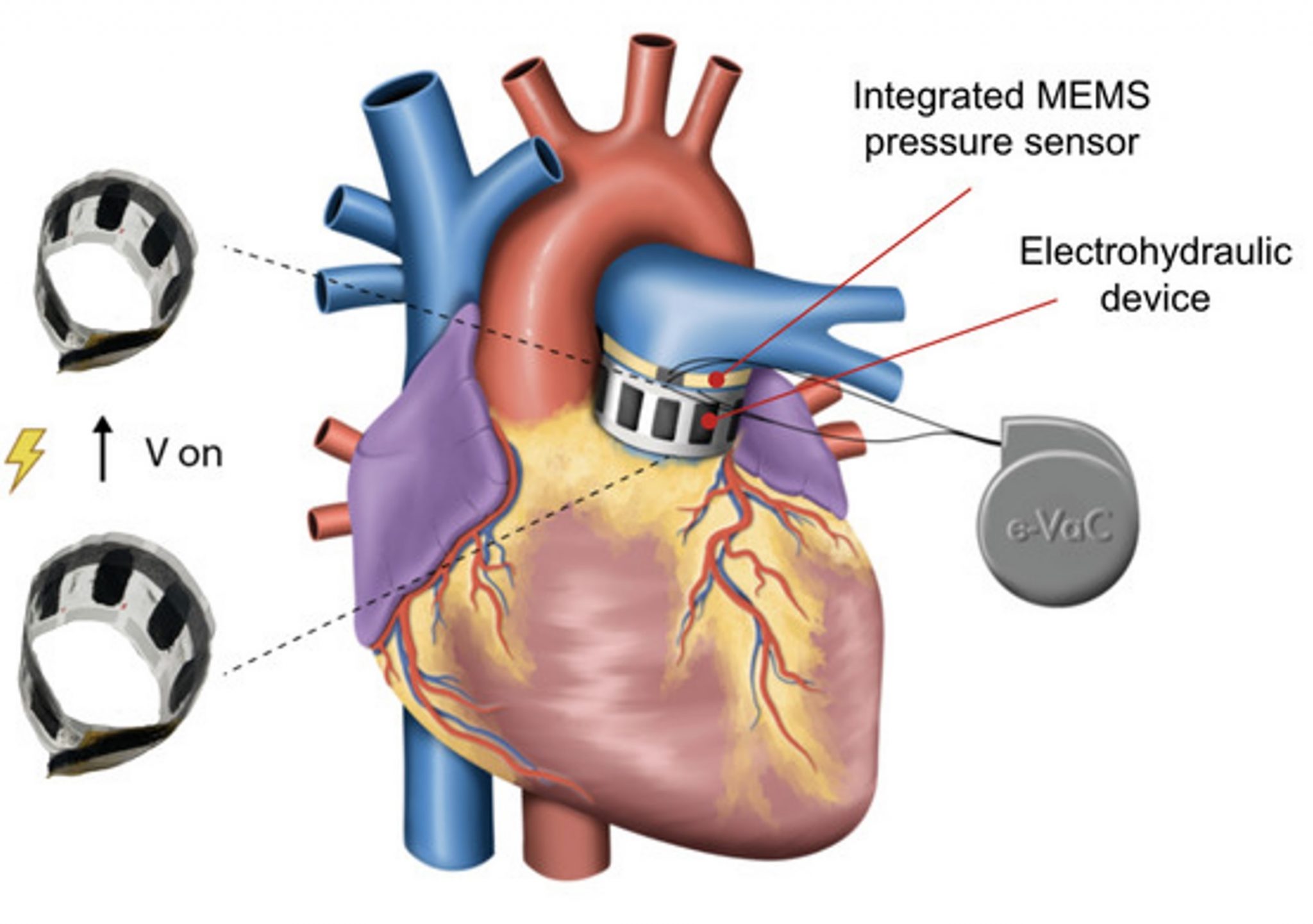 Semester project proposals – Spring 2023 ‒ LAI ‐ EPFL