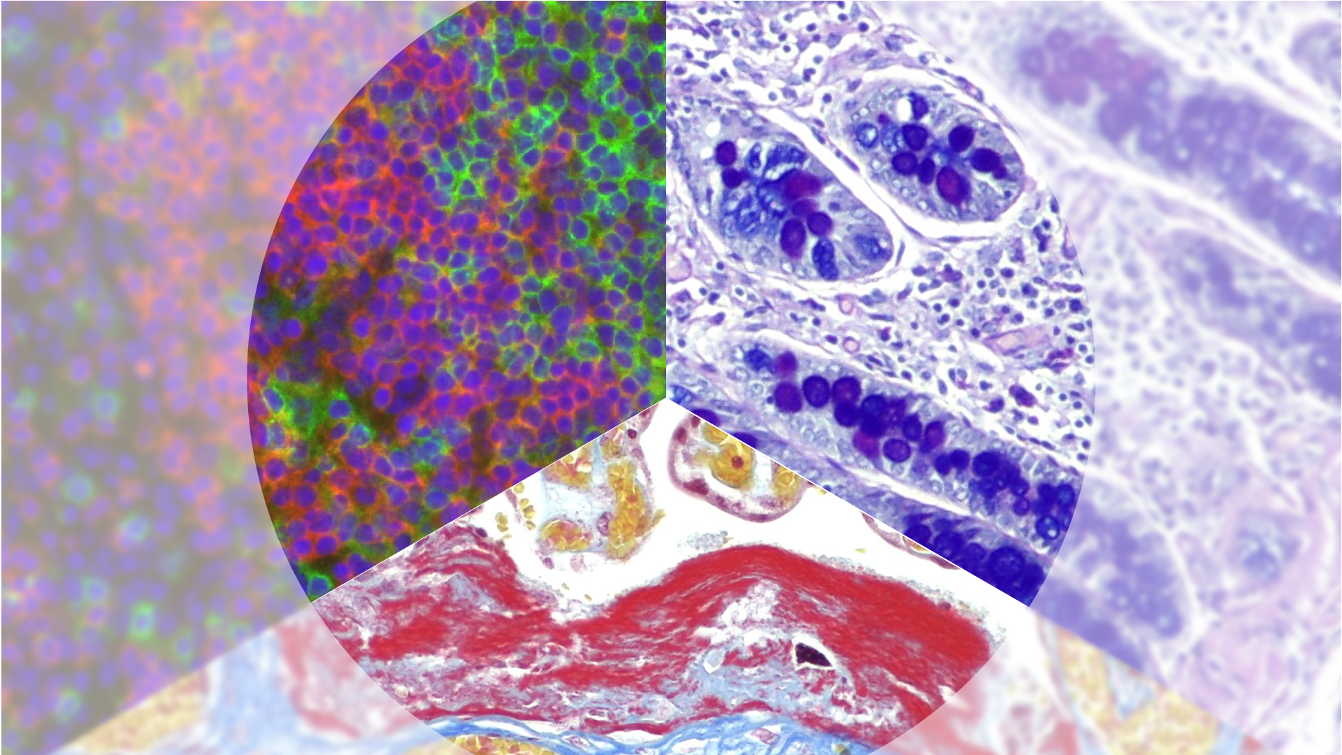 Parathyroid Histologi Merket